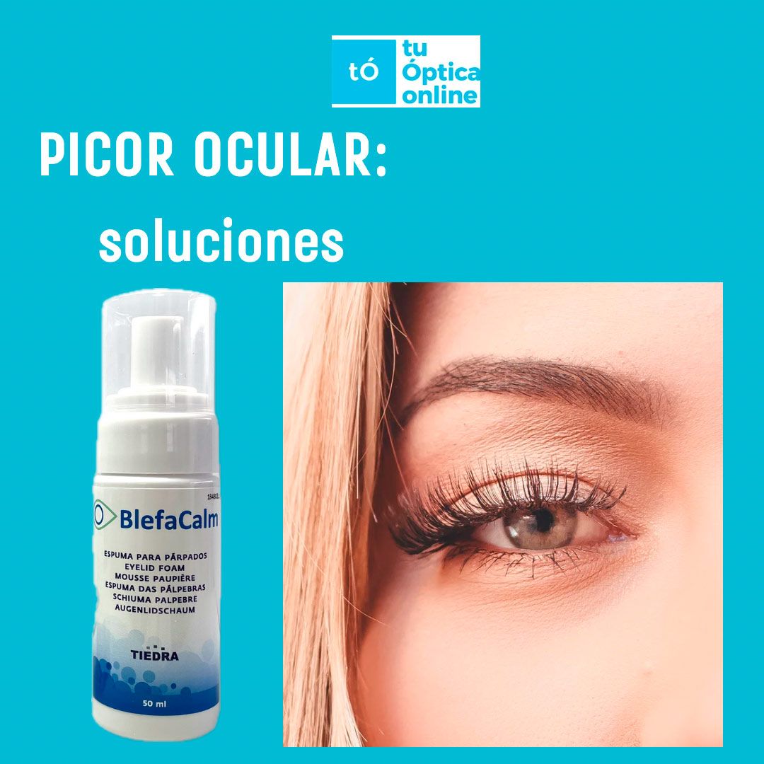 Soluciones para el picor ocular